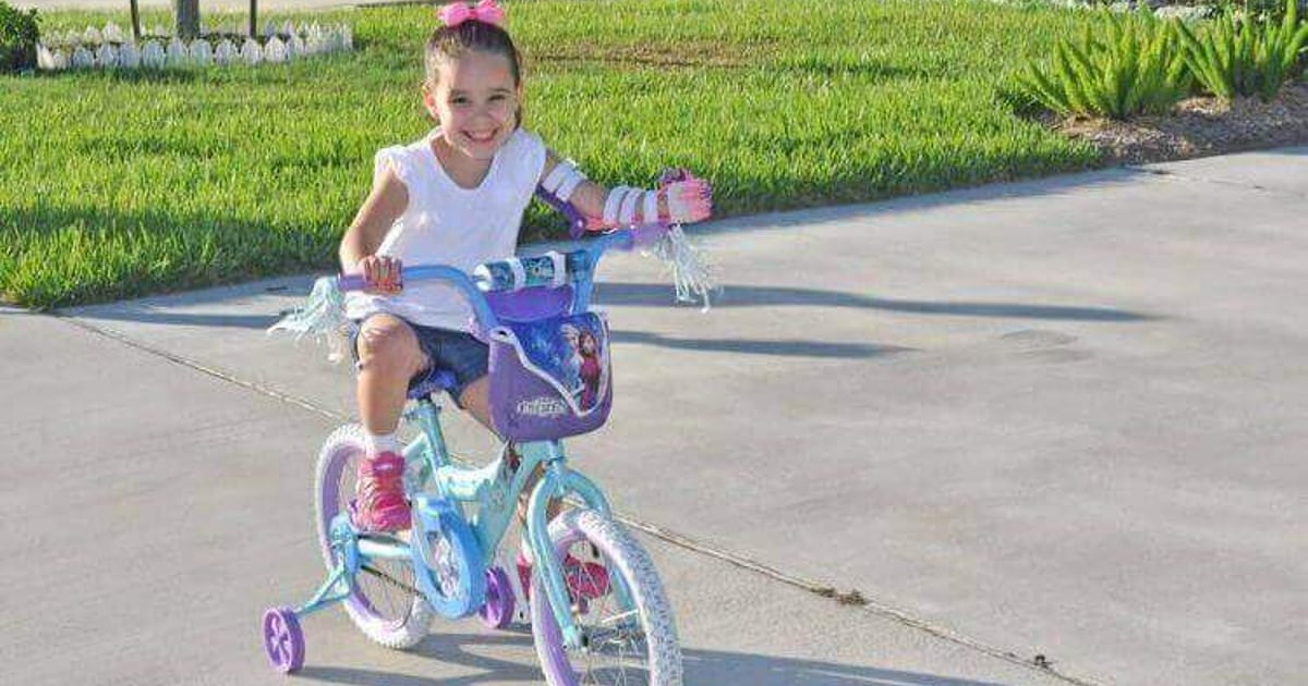 Public Library uses 3D Printer to give 5-year-old Girl a Prosthetic ...