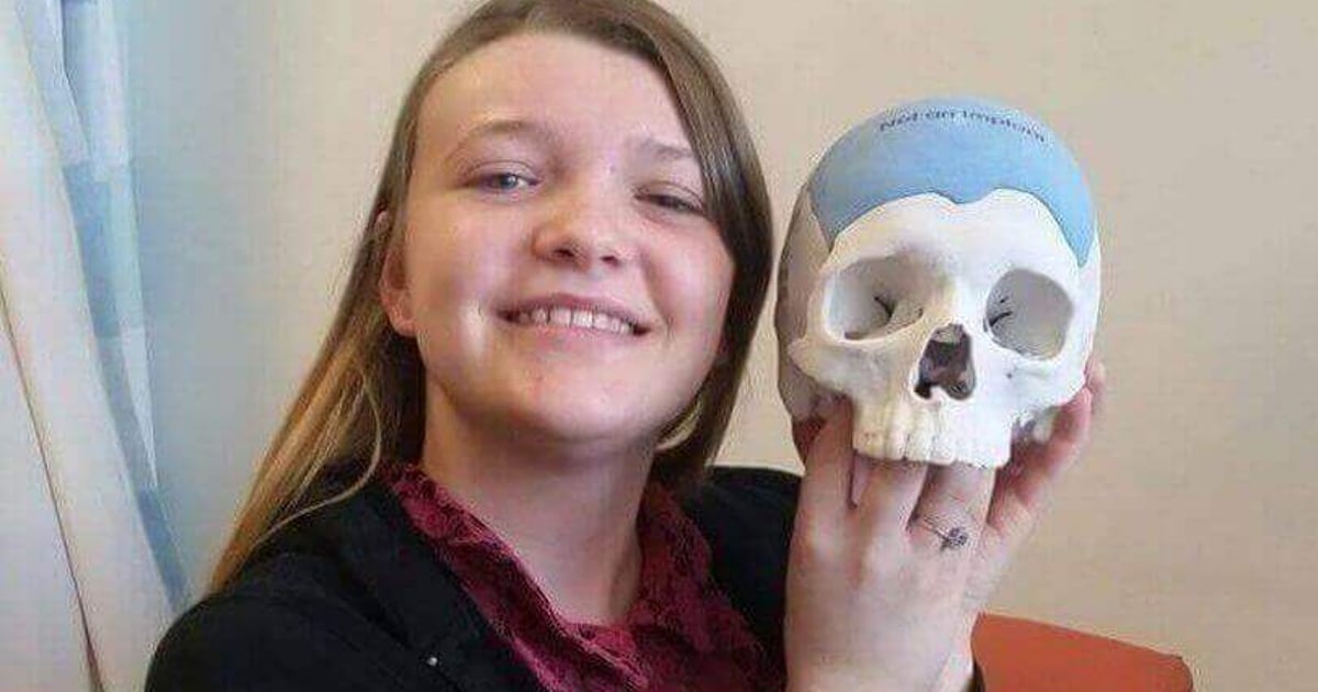 Woman Receives 3D Printed Skull Implant After Brain Tumor Removal | All3DP