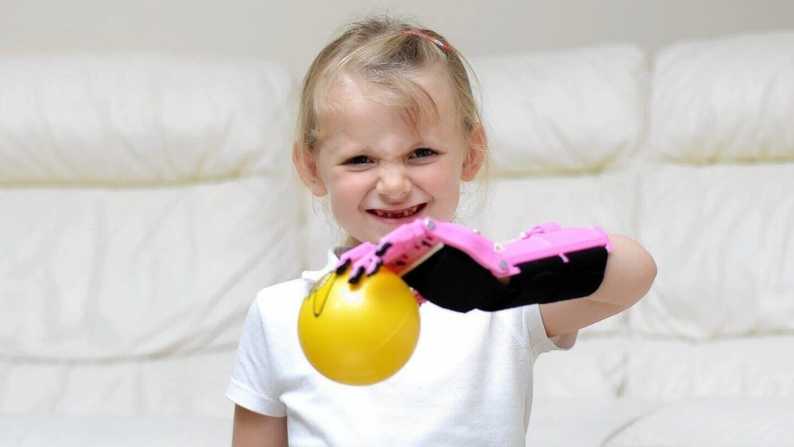E-Nabling Everyone to Give a 3D Printed Hand | All3DP