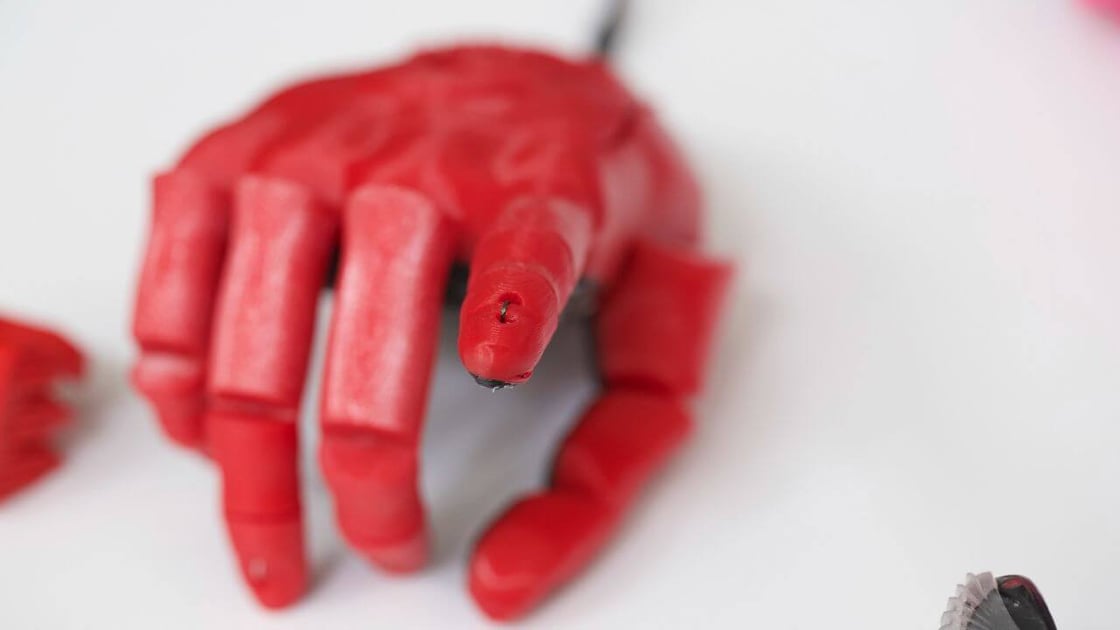 Open Bionics Begins World First Bionic Hand Trial in Bristol | All3DP