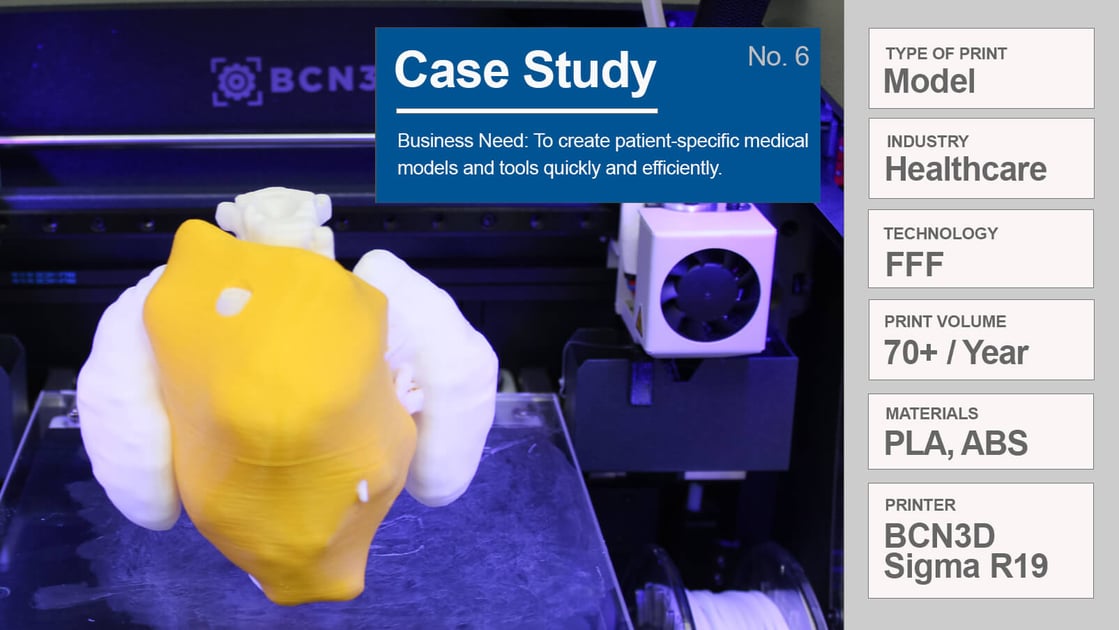Case Study: Why Hospitals Need 3D Printers | All3DP Pro
