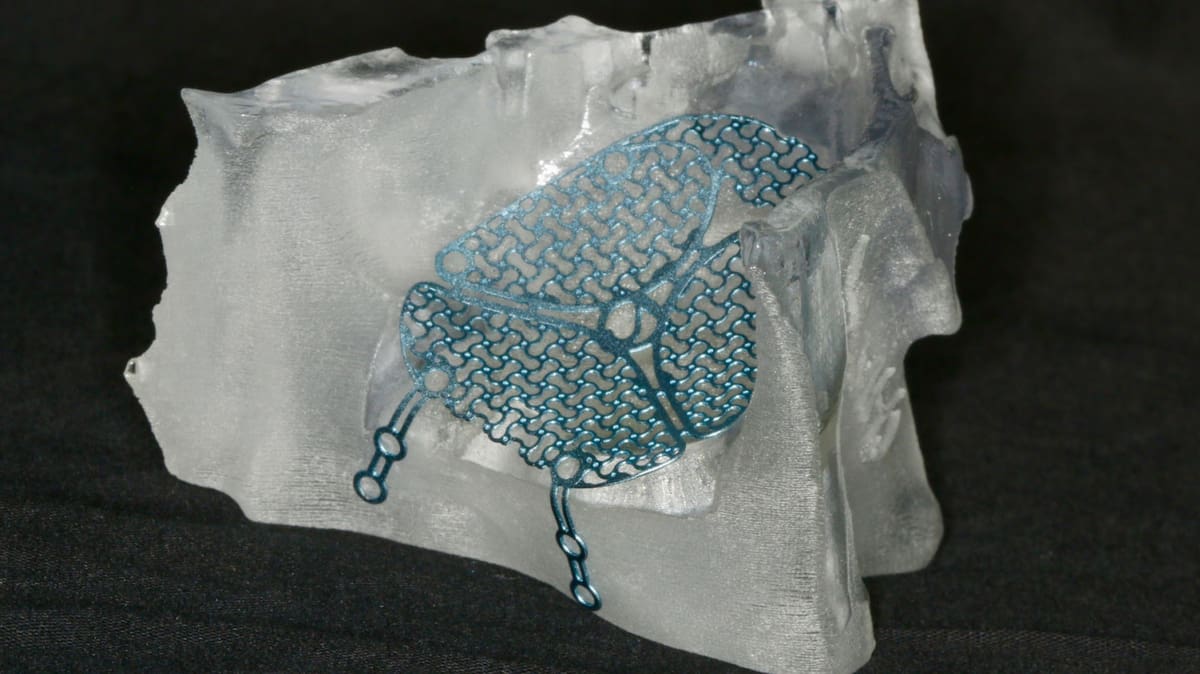 Boosting Surgical Outcomes with 3D Printing at University Hospital ...