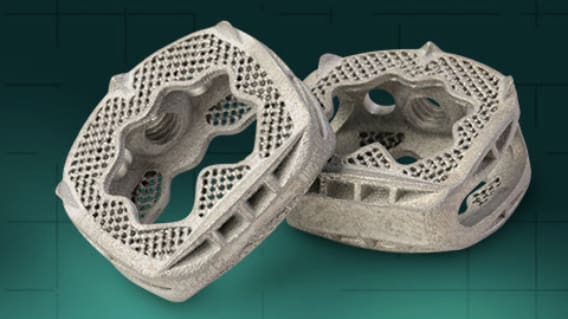 Additive Implants' 3D Printed SureMAX Cervical Spacer Cleared by FDA | All3DP