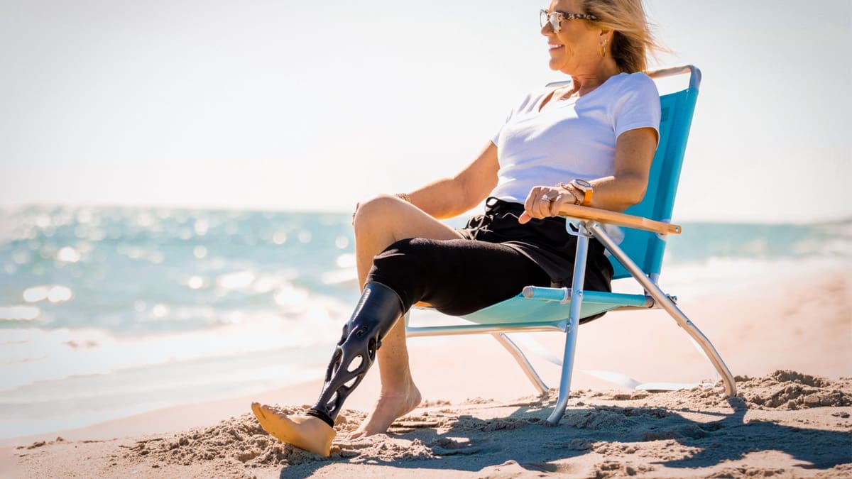 3d printed prosthetics