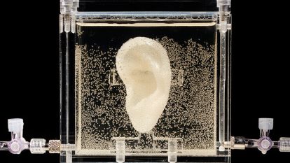 3D Bioprinting the Lost Ear of Vincent van Gogh | All3DP