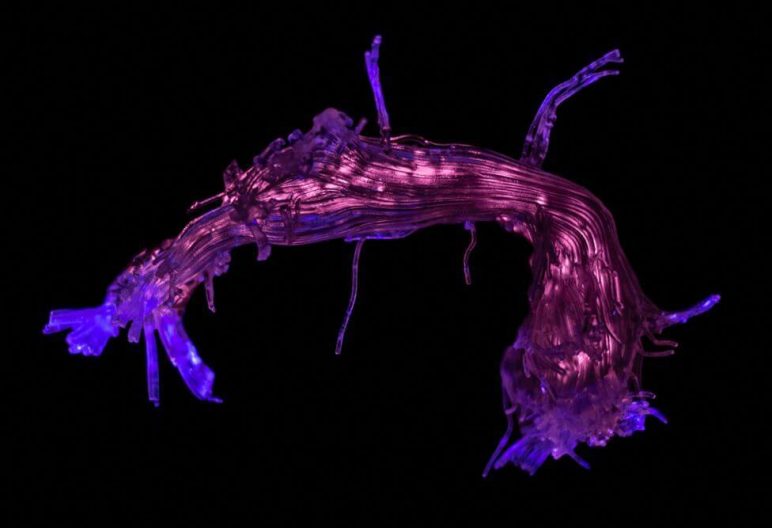 3D Printed Pig's-Eye Model Shortlisted for Wellcome Image Awards 2017 ...