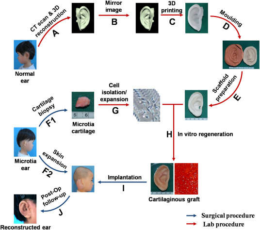 Researchers 3D Bioprint the First Ears Made From Childen’s Own Cells ...