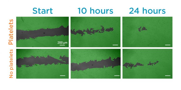 Printable Body Tissue with Personalized Bio-Inks Boost Healing ...
