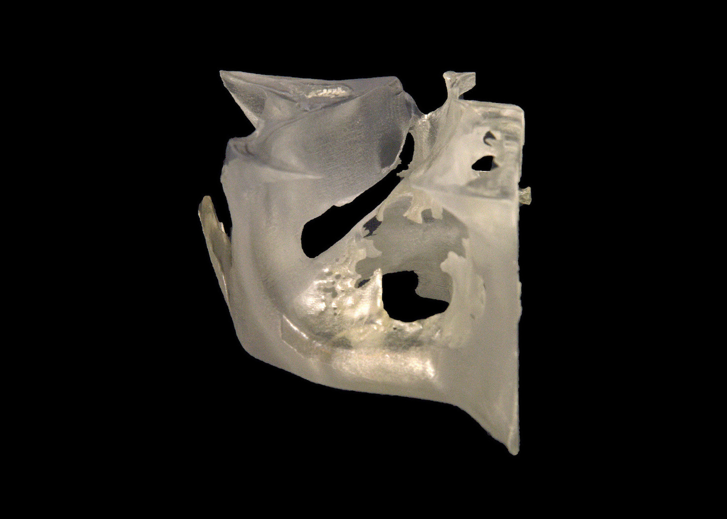 Boosting Surgical Outcomes with 3D Printing at University Hospital ...