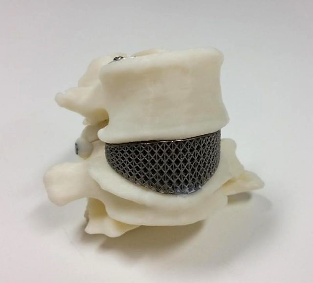 3D Printed Medical Devices – What Can Be Printed Today? | All3DP