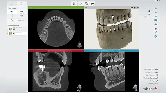 Dental 3D Scanning – Next Level Imaging in Dentistry | All3DP
